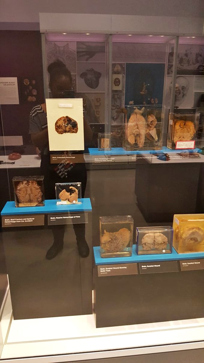 Preserved specimens that tell silent stories of human fragility and resilience. Each container holds chapters of medical history more compelling than fiction.